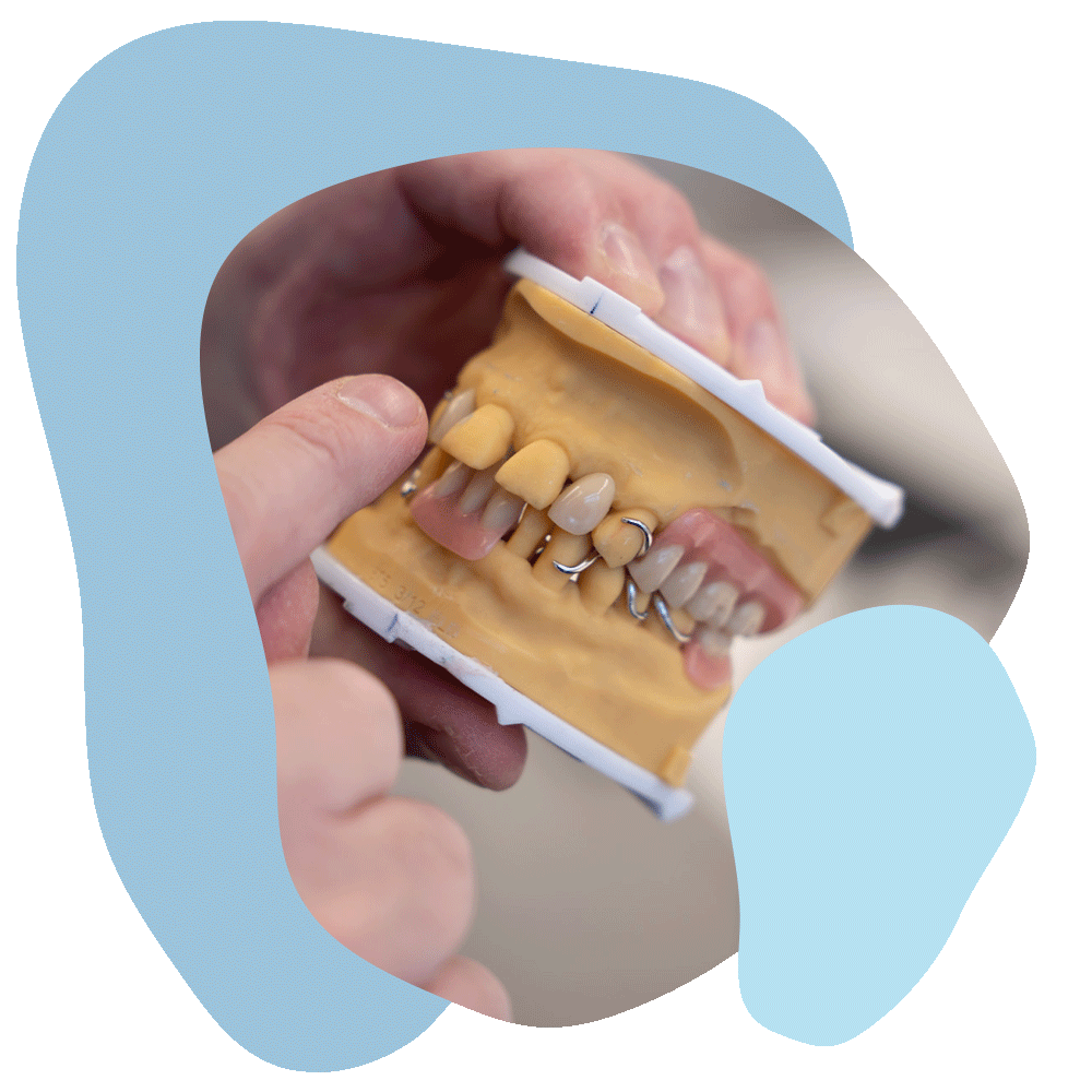 Delprotese - Tandprotese Klinikken Esbjerg